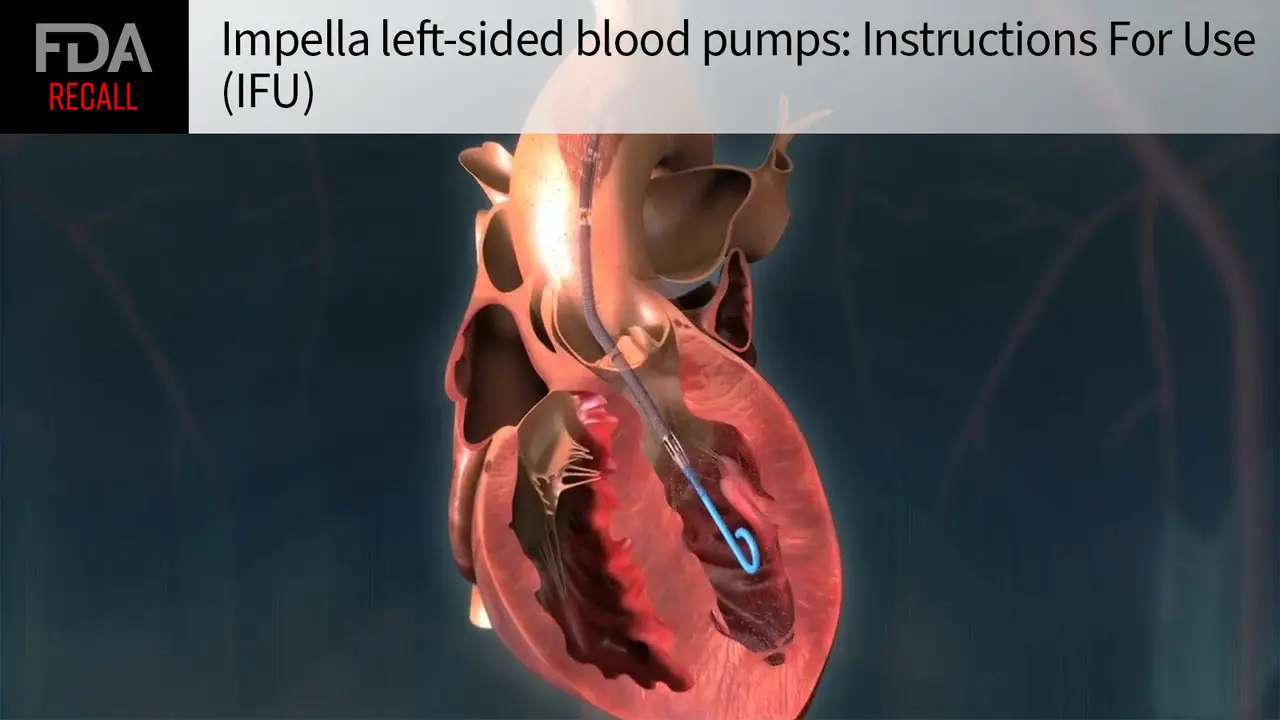 Legal Help for Abiomed Impella Heart Pump Victims